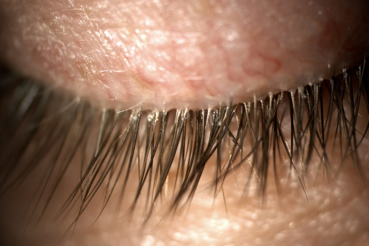 Behandlung – Bischof Optik